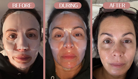 Bio-Collagen Mask – Glow Lily